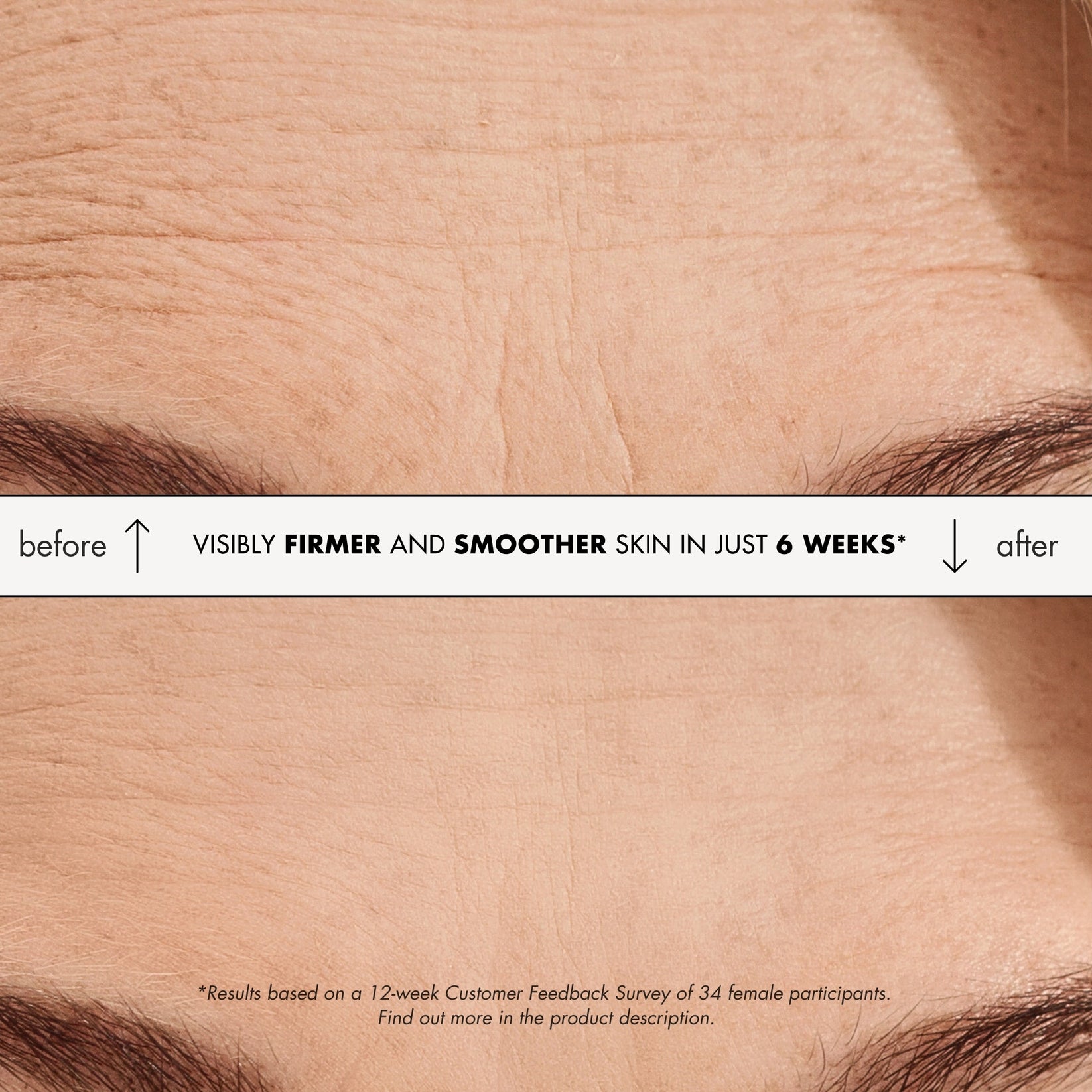 Regenerating Day Cream: Anti-Wrinkle Cream | AgeDefy ProSynergy X ...